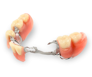 Mandibular Partial Denture