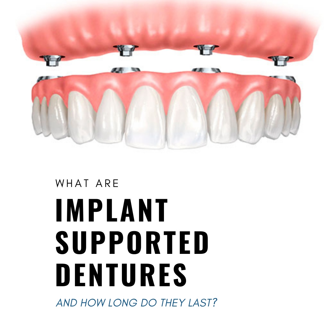 IMPLANT SUPPORTED DENTURES | YYC Denture Clinic
